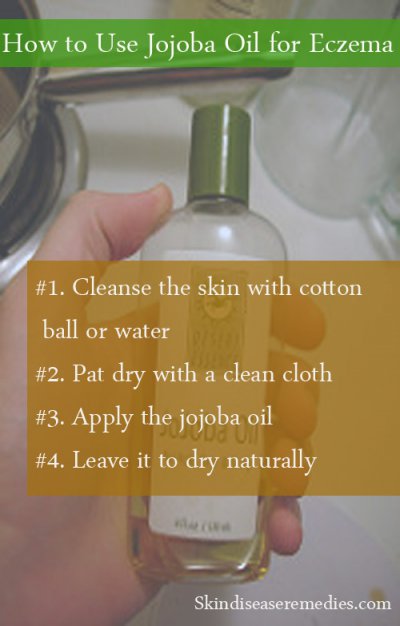 How To Use Jojoba Oil For Eczema 10 Methods Skin Disease Remedies